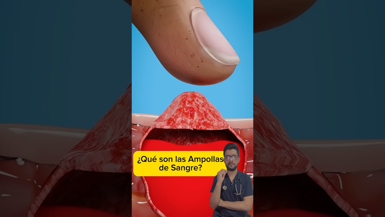Todo lo que debes saber sobre el ampoa de sangre: causas, síntomas y ...